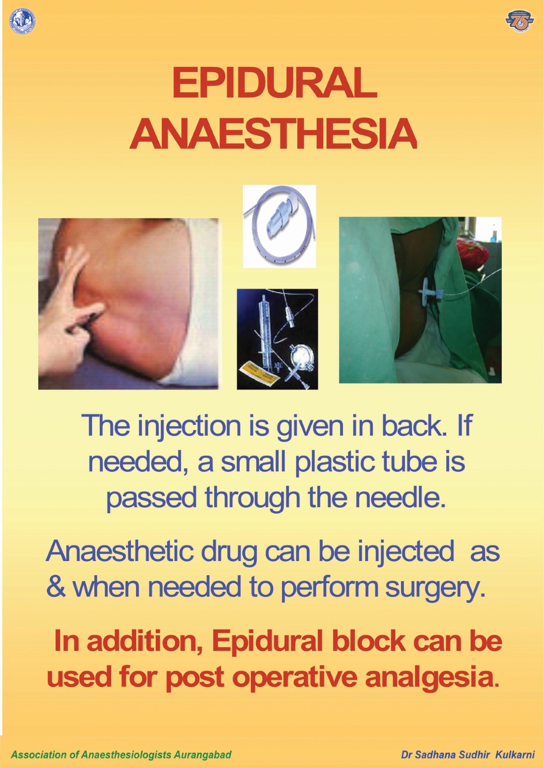 ISA - Aurangabad Anesthesia Association